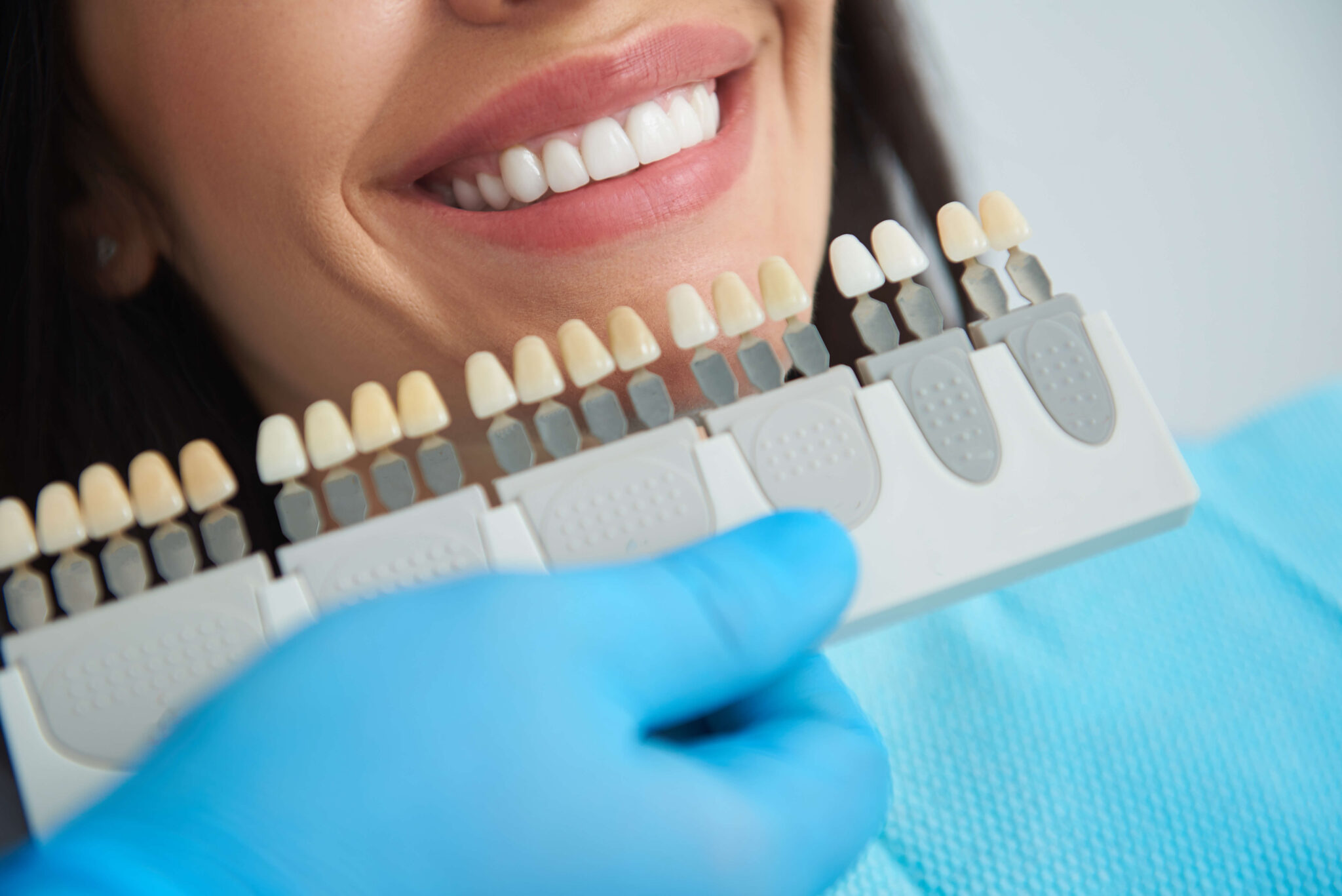 Turkey teeth before and after - Cosmedica Dental Clinic