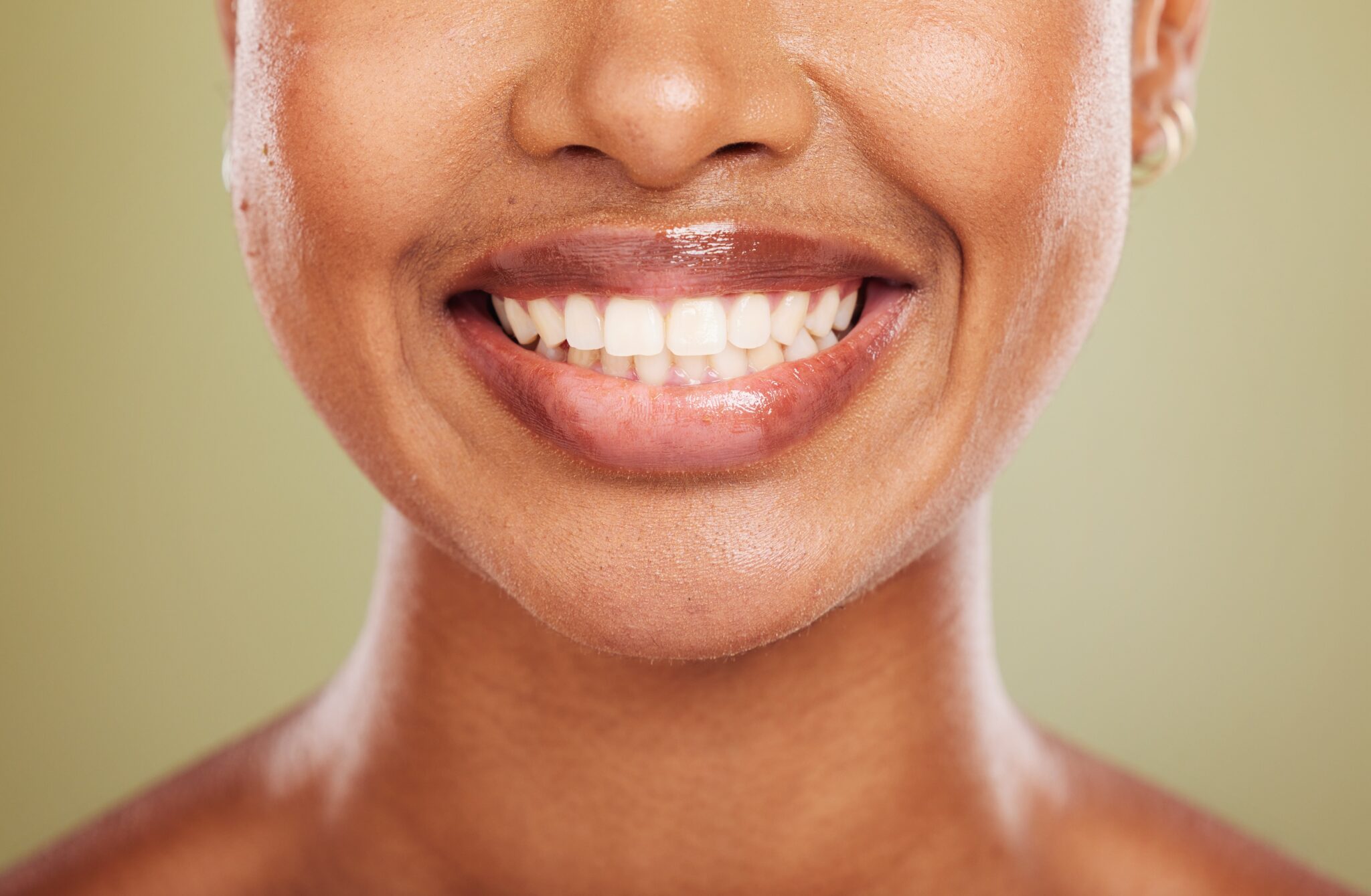 Front Tooth Crown - cosmedicadental.com